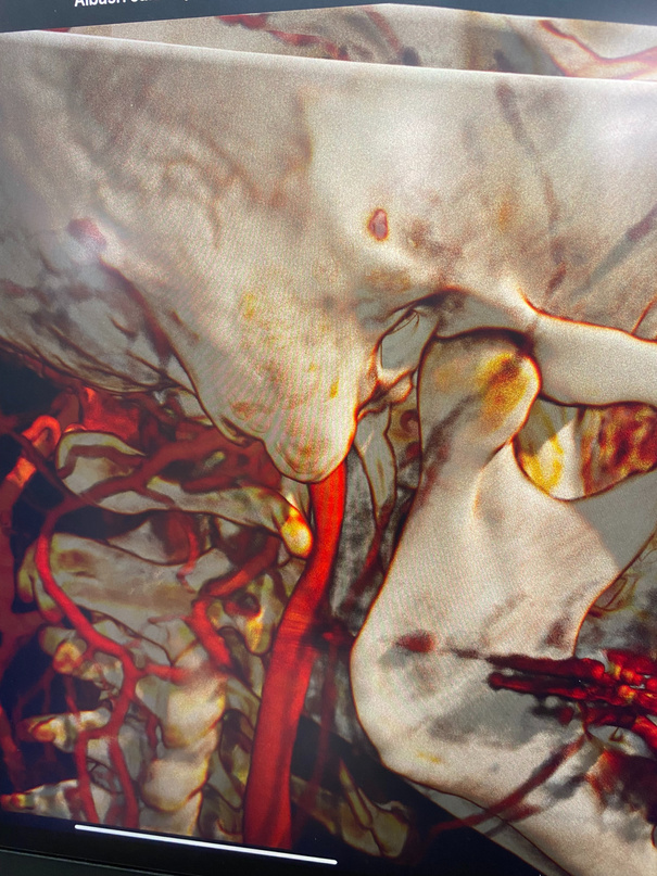 It's All About Blood Flow - EPIC Clinics